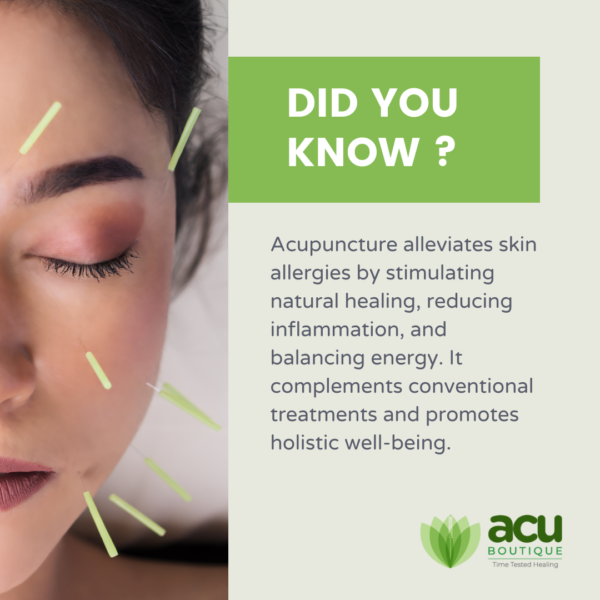 Acupuncture for Skin Allergies: Facts - Acu Boutique