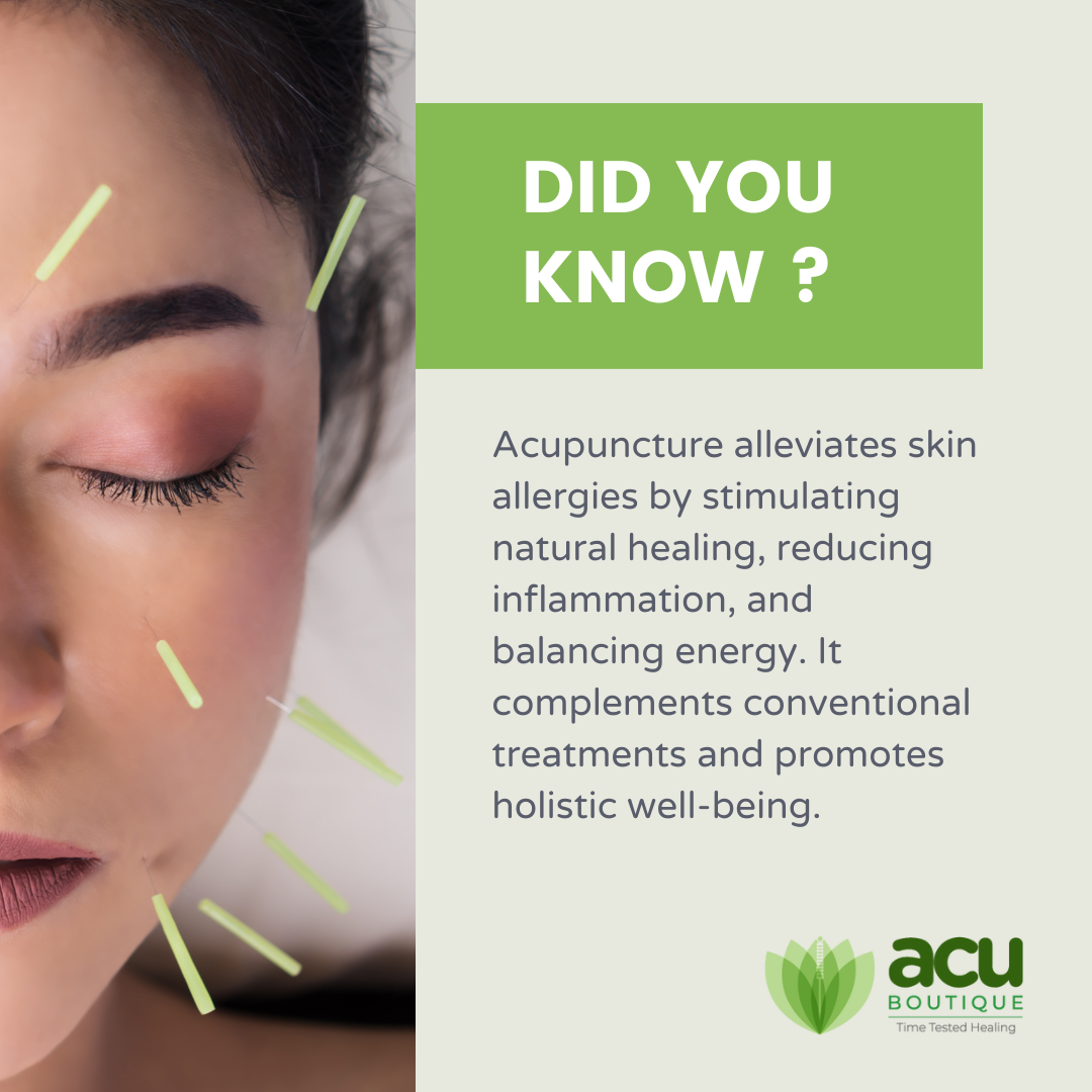 Acupuncture for Skin Allergies: Facts - Acu Boutique